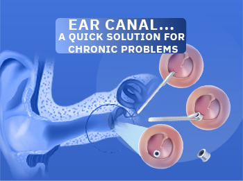 Ear Tubes: A Quick Solution for Chronic Issues