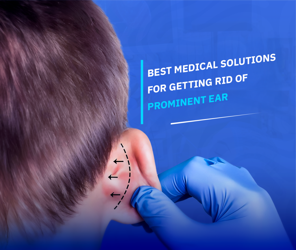 Bat Ear: Causes, Treatment Options, and Surgical Considerations