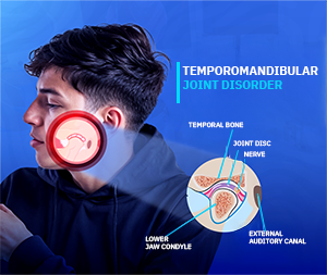 Temporomandibular Disorders: Causes, Symptoms & Treatment