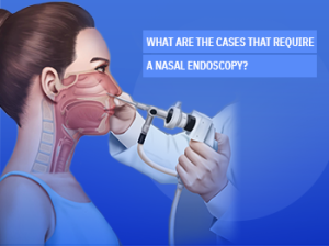 The Rhinoscope: A Key Tool in Modern ENT Diagnostics and Treatment