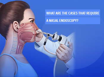 The Rhinoscope: A Key Tool in Modern ENT Diagnostics and Treatment